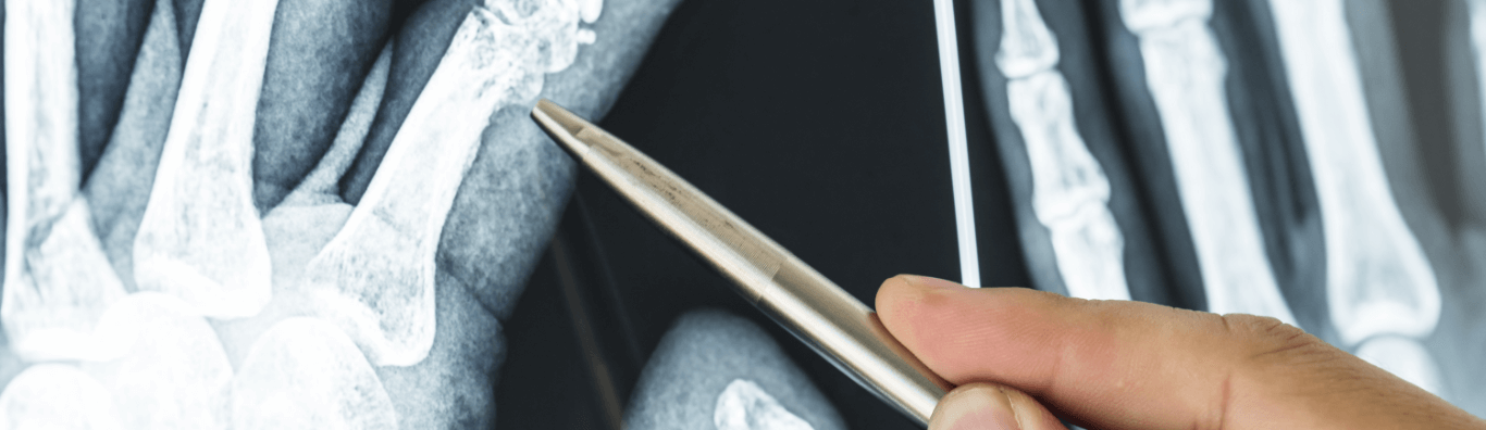 BONE DENSITY SCAN - Truecheck Diagnostics