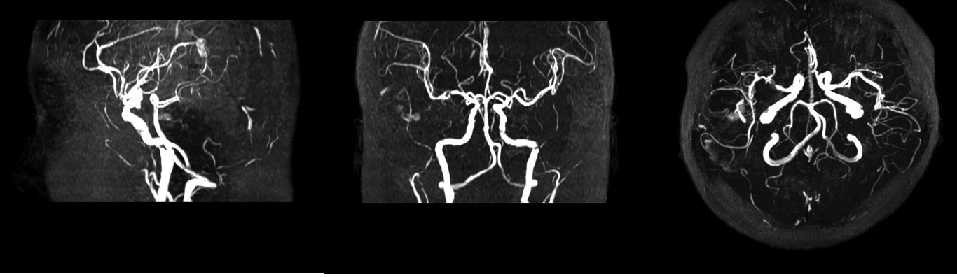 Latest Technology With Care For Angiography Test in Mumbai